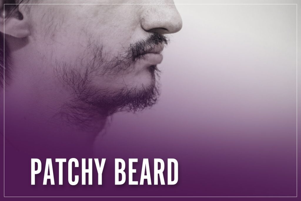 Patchy Beard: Causes, How To Fix & Fill In The Patches I Full 2023 Guide